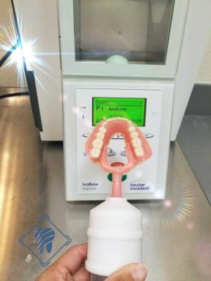 Ivoclar Vivadent IvoBase Injector Injection Systems | SHINODA DENTAL