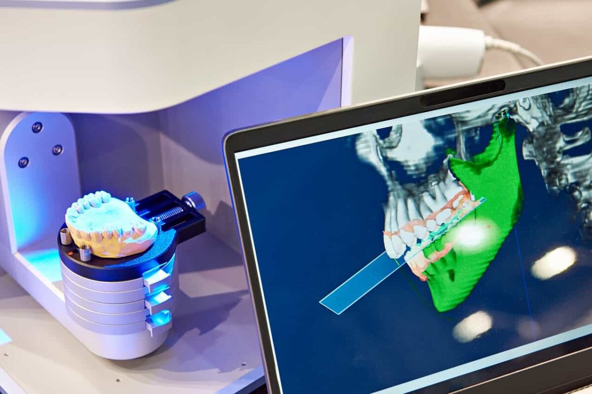 Top 10 Dental Milling Machines for Modern Dental Laboratories: An ...